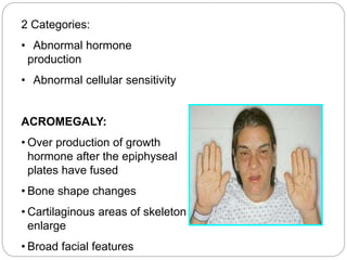 endocrine system | PPTX