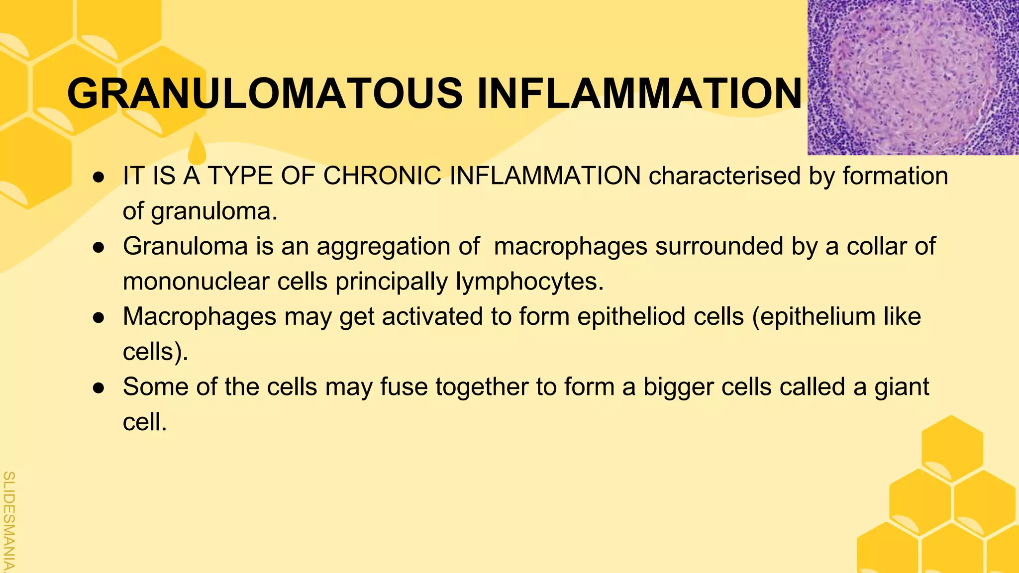 chronic inflammation | PPTX