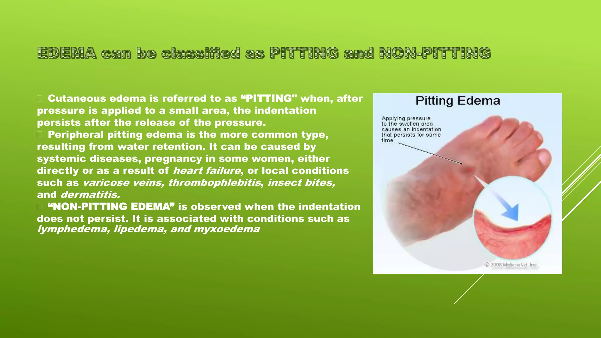 edema pathology | PPTX