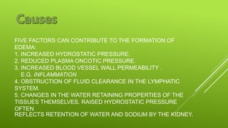 edema pathology | PPTX