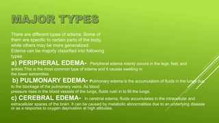 edema pathology | PPTX