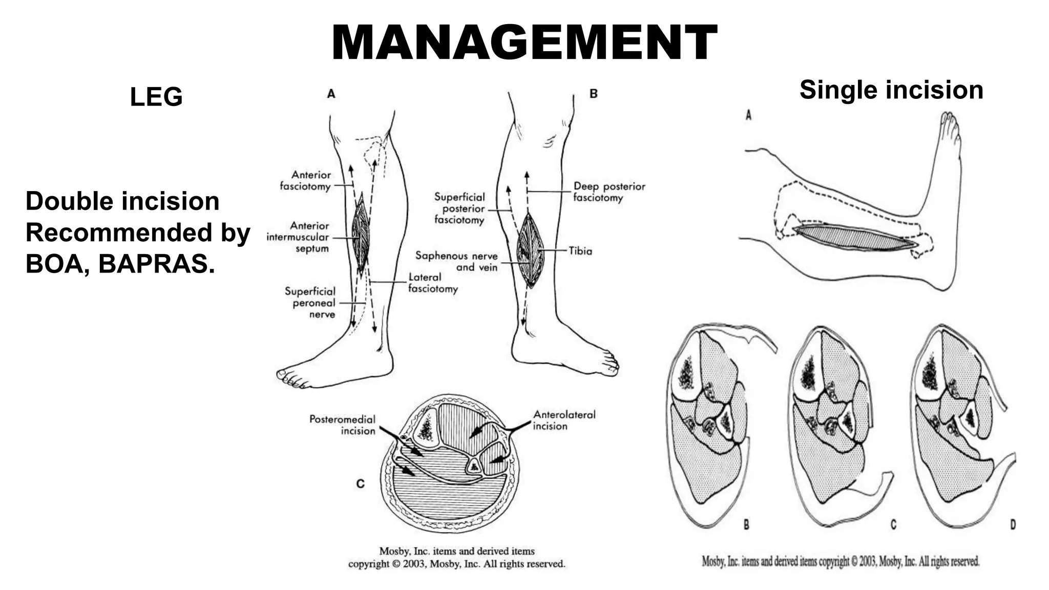 Pathology and management of compartment syndrome in orthopedics 1 | PPT