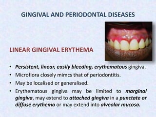 Linear Gingival Erythema
