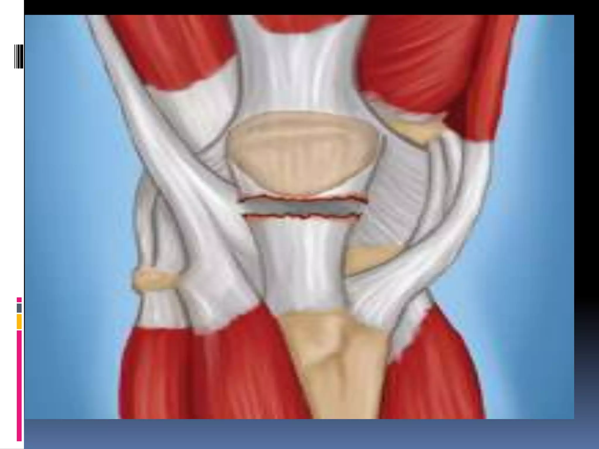 PATHOLOGY AND MECHANISM OF COMMON SPORTS INJURY TO.pptx