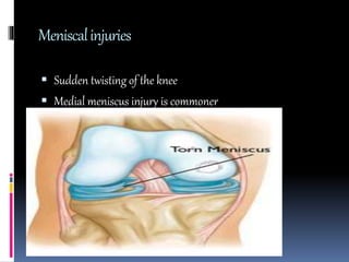 PATHOLOGY AND MECHANISM OF COMMON SPORTS INJURY TO.pptx
