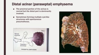 Pathology basic introduction to pathology of common lung diseases for ...