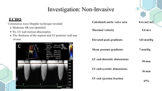 Severe Aortic Stenosis with Ischemic Heart Disease. (Management of TAVI ...