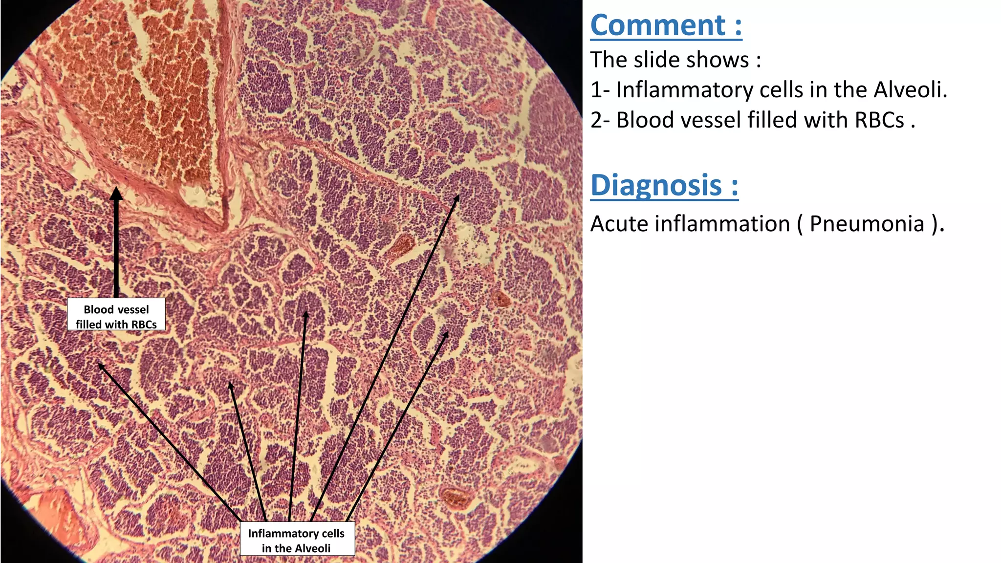 Pathology (cell injury and necrosis) | PPT