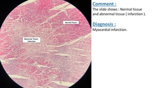 Pathology (cell injury and necrosis) | PPT