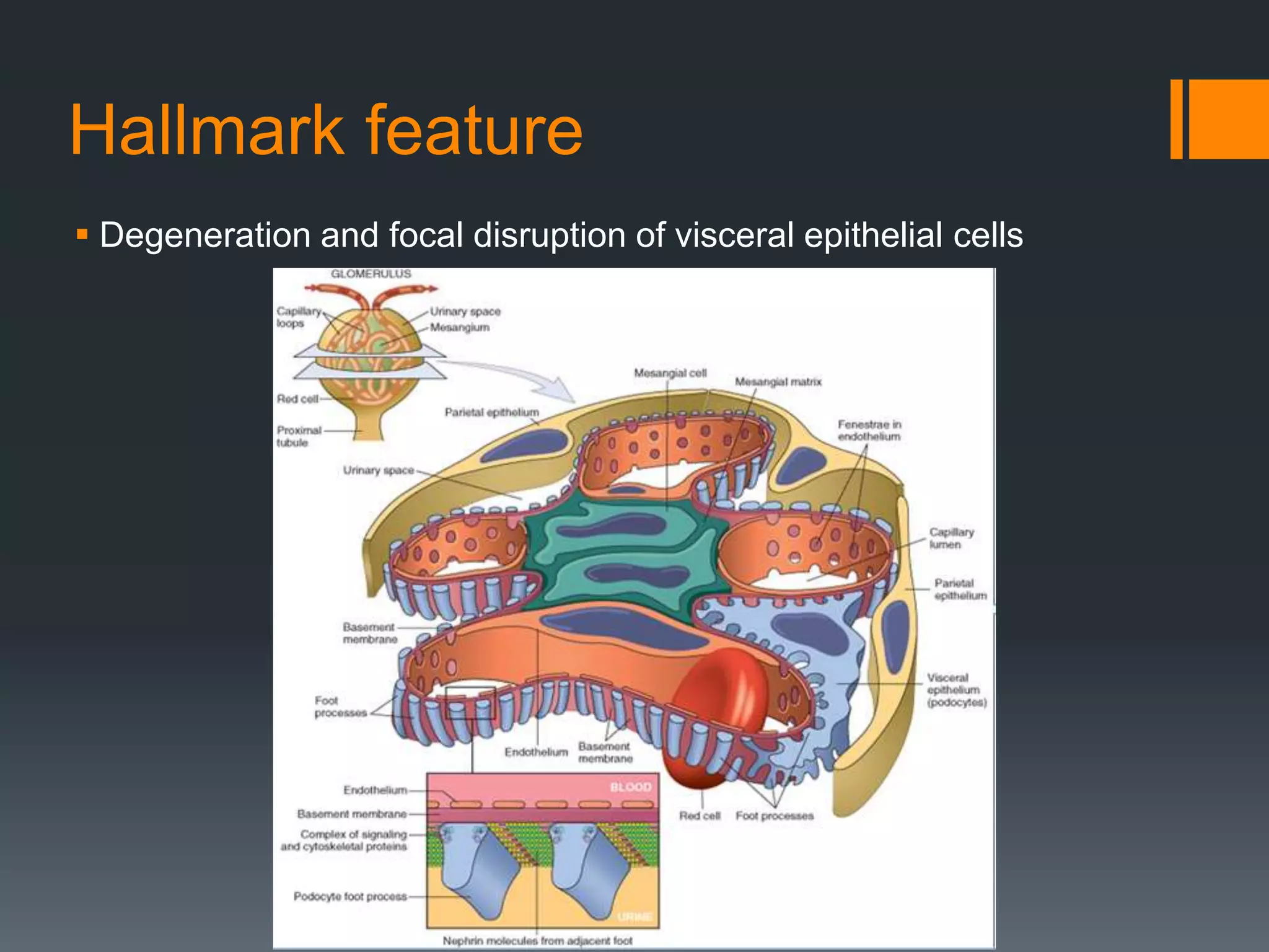 Focal Segmental Glomerulosclerosis - Pathology - FSGS | PPTX