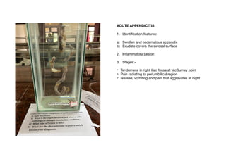 Second year Pathology Gross Spotters.pdf