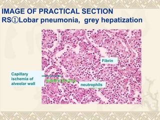Pathology I Practical Review (2) Pathology I Practical Review .ppt