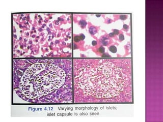 Islet cell Pathology | PPTX