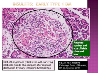 Islet cell Pathology | PPTX
