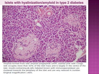 Islet cell Pathology | PPTX