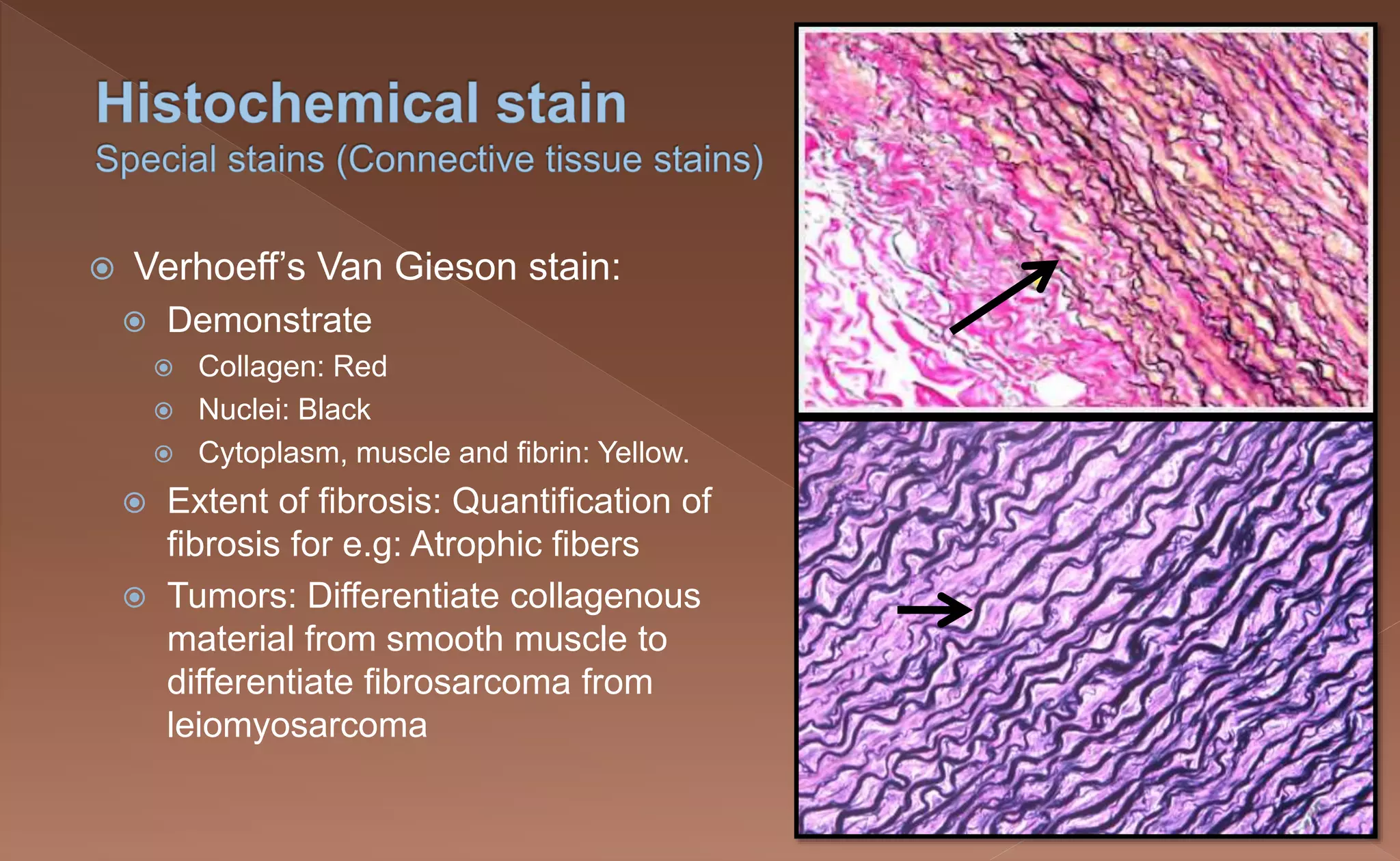 Basic laboratory techniques, special stains and immunohistochemistry in ...