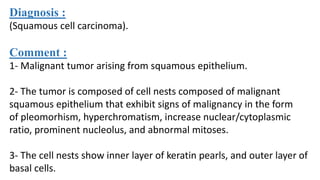 Pathology (microscopic feature of some tumors) | PDF