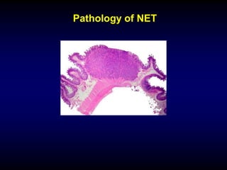 Pathology NET.ppt