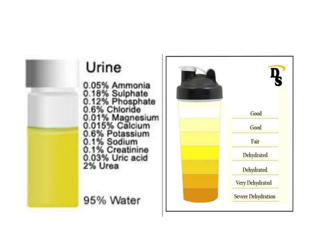 Pathology of blood and urine | PPTX | Blood Disorders | Diseases and ...