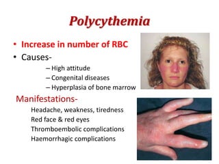 Pathology of blood and urine | PPTX