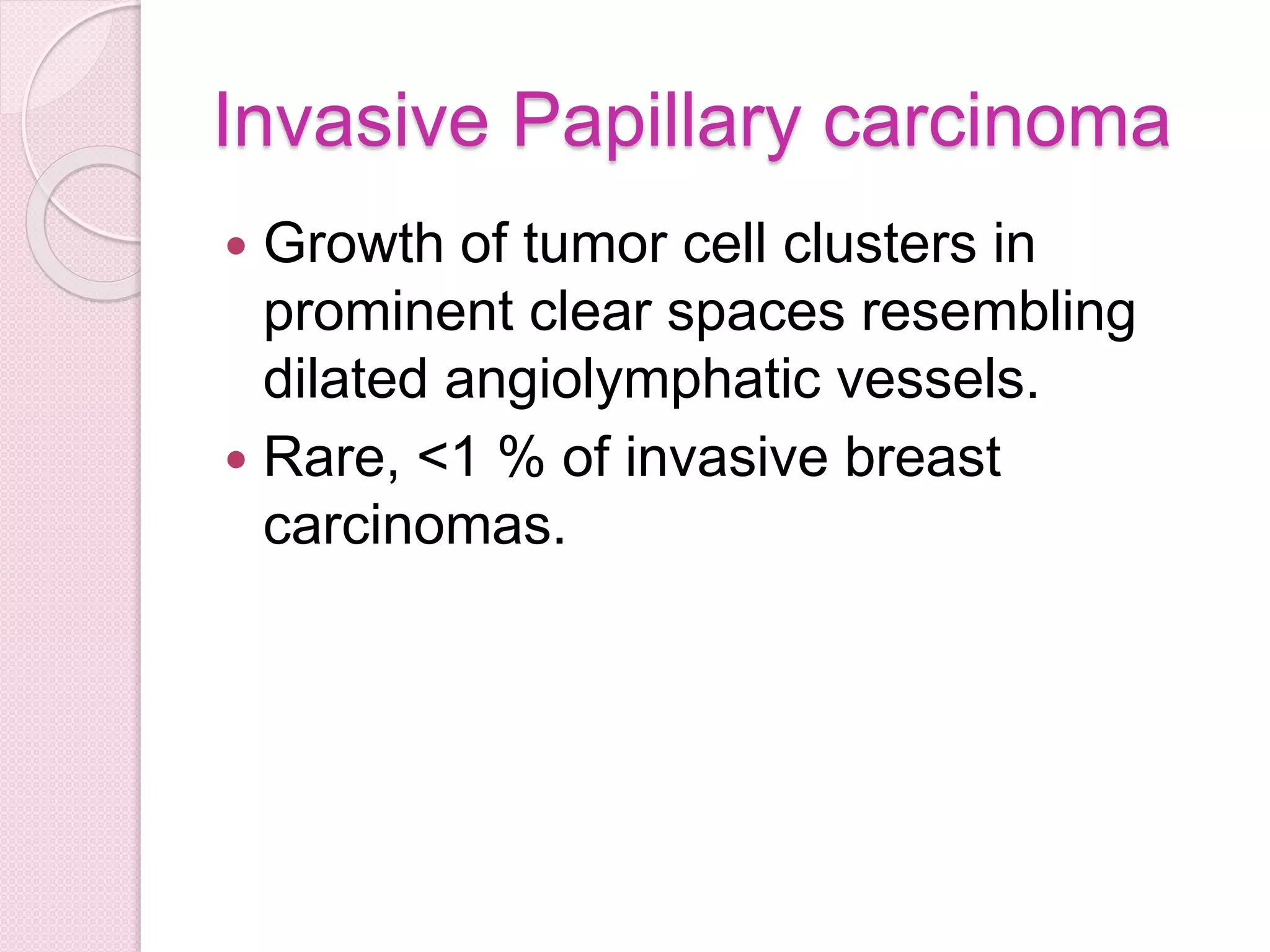 Pathology of carcinoma breast | PPTX