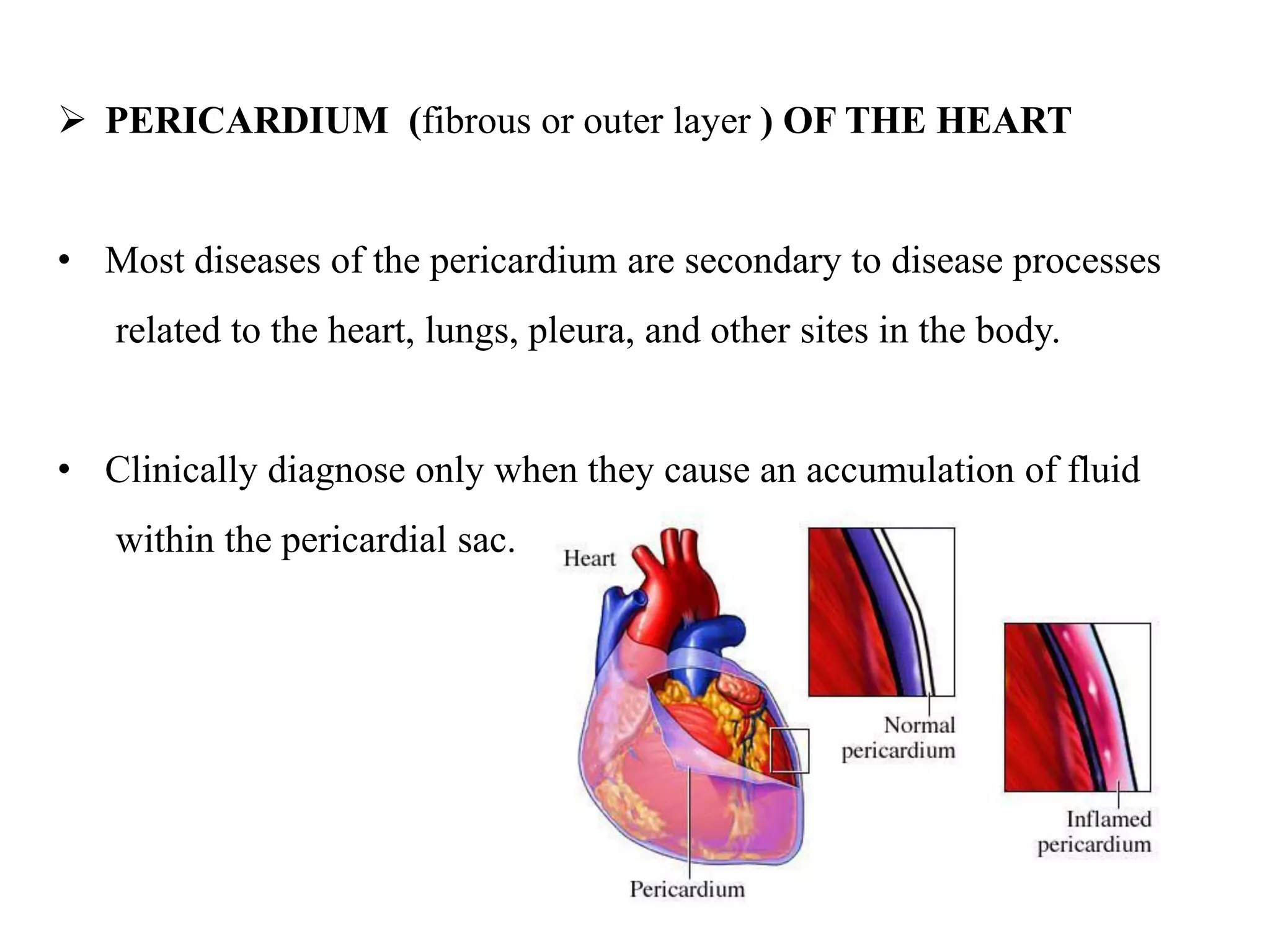 Pathology of cardiovascular system | PDF