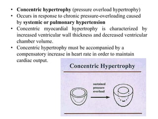 Pathology of cardiovascular system | PDF