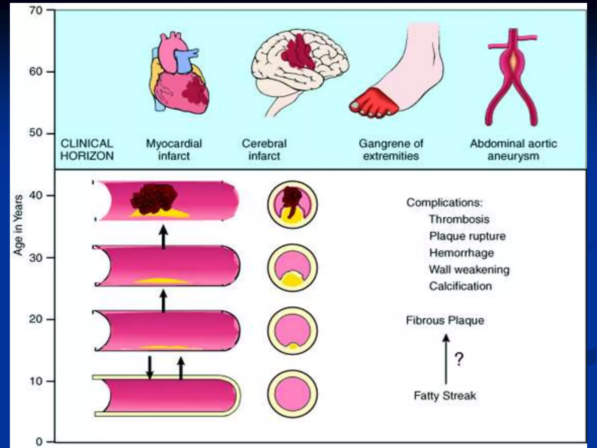 Pathology of cardiovascular system | PPT | Heart and Cardiovascular ...