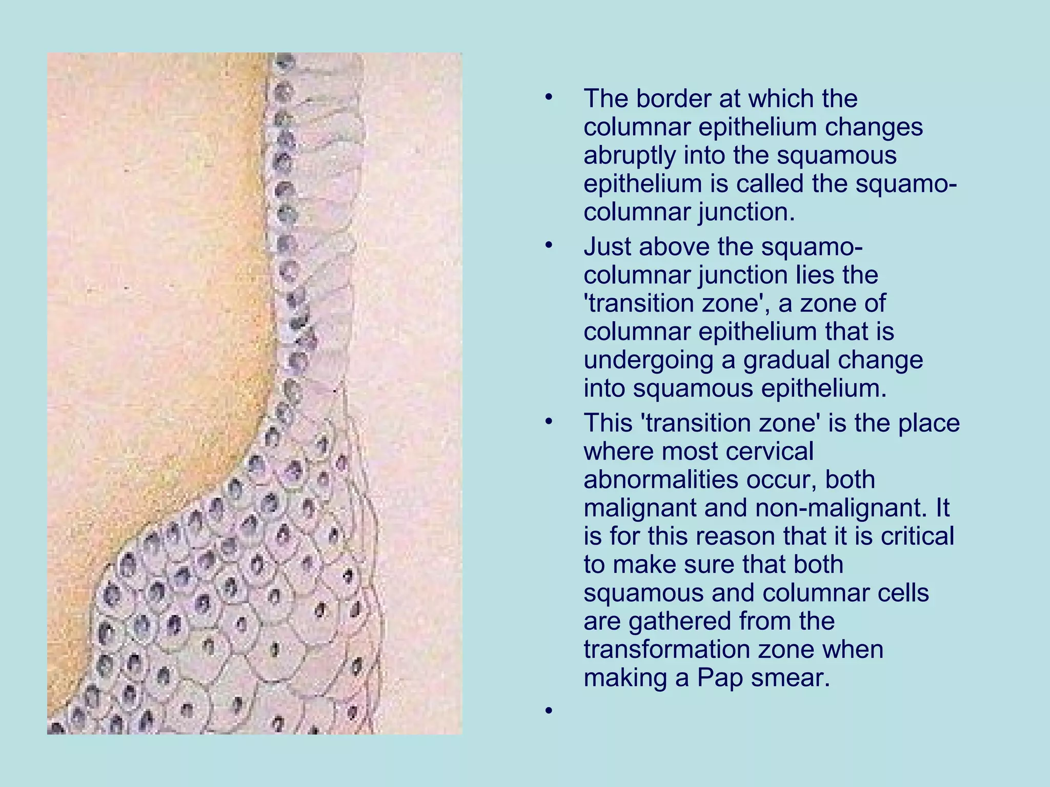 Pathology of cervix | PPT