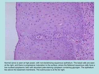 Pathology of cervix | PPT