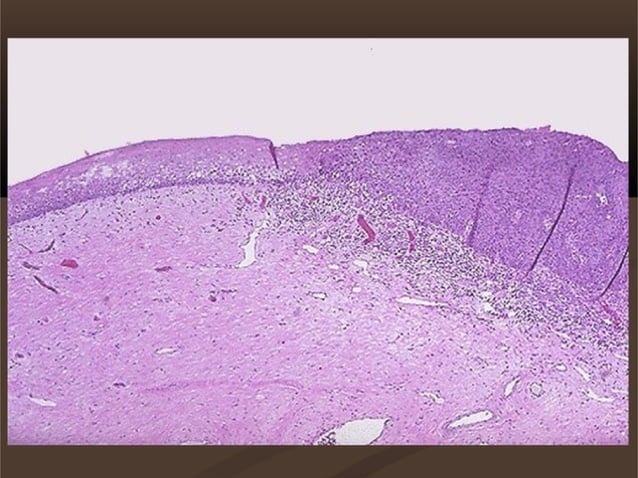 Pathological lesions of cervix.ppt benign and malignant lesions of ...