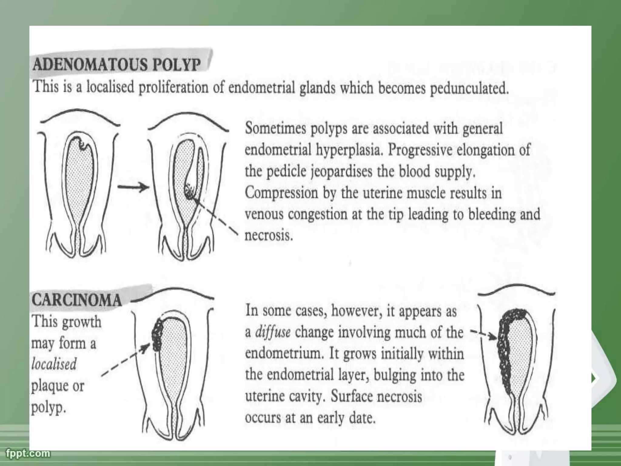 Pathology of cervix &uterus | PPTX
