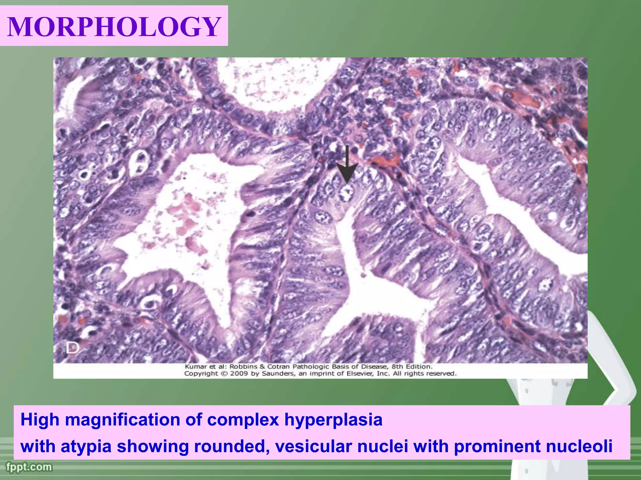 Pathology of cervix &uterus | PPTX