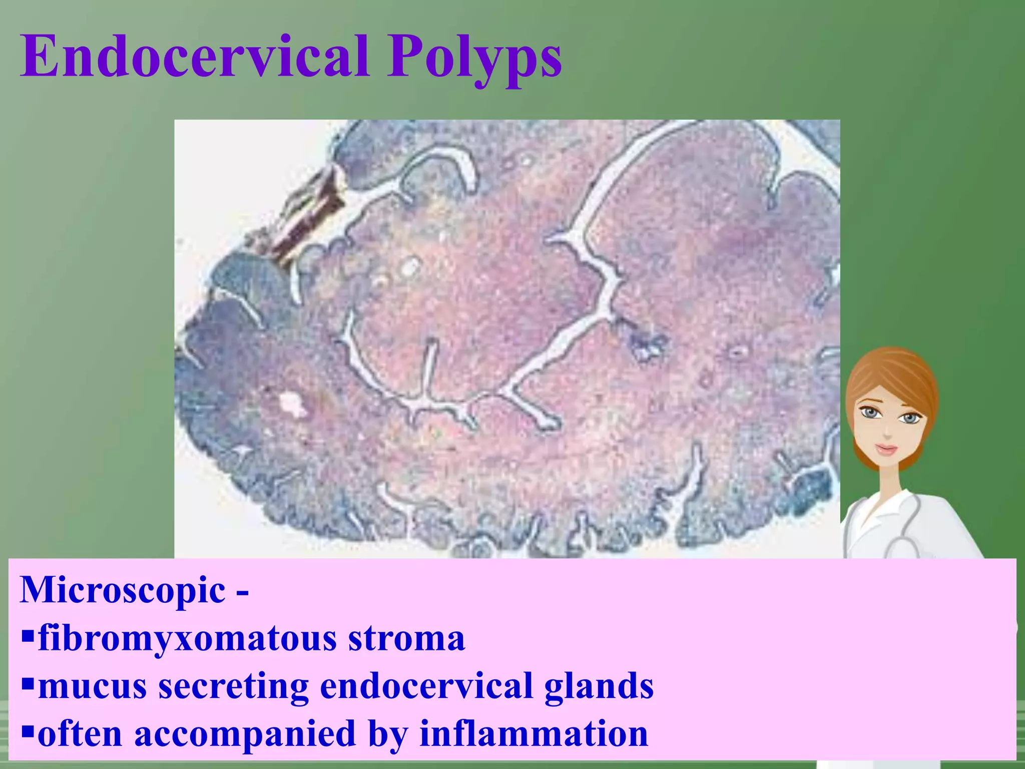 Pathology of cervix &uterus | PPTX