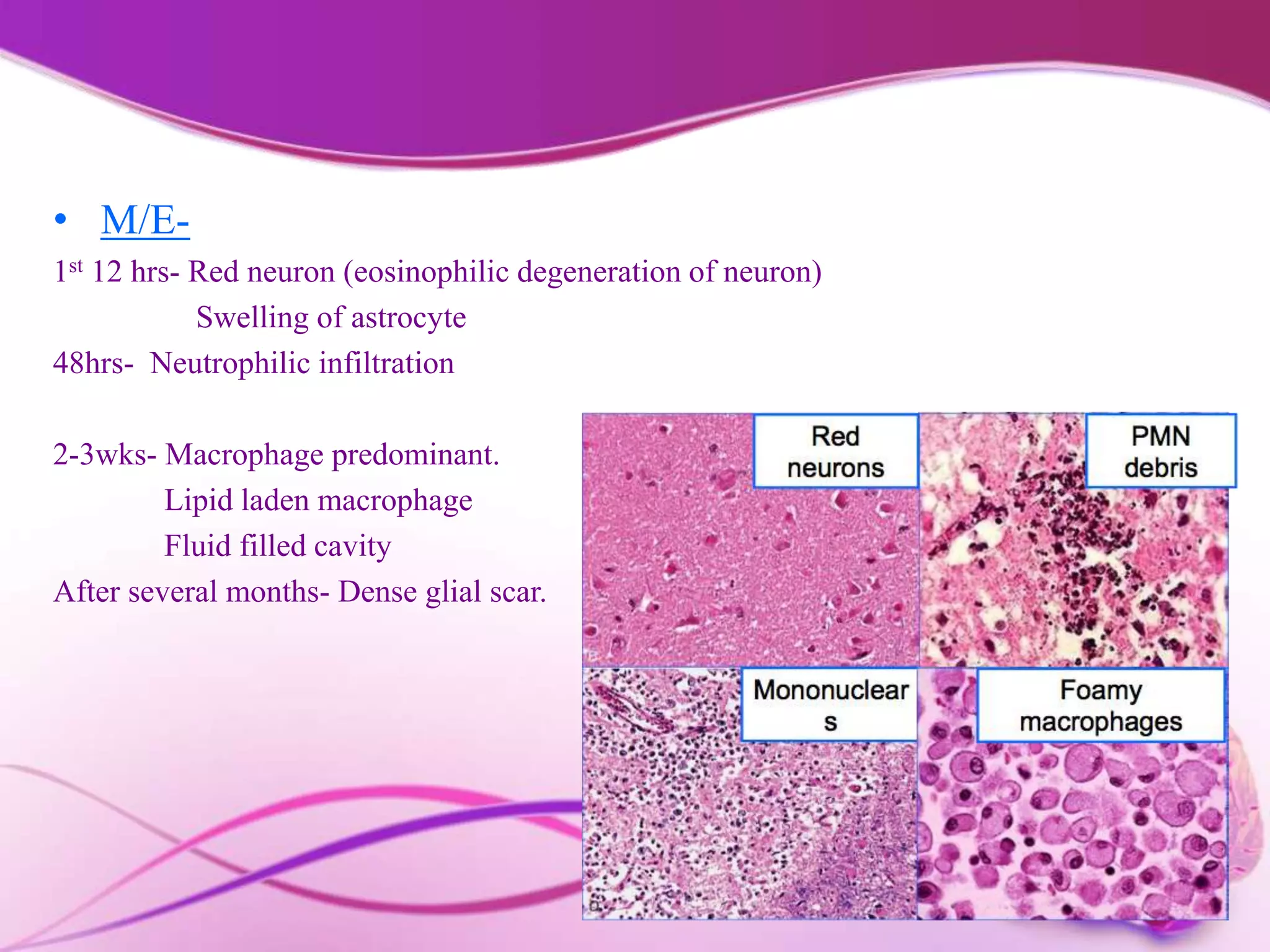Pathology of cns | PPTX