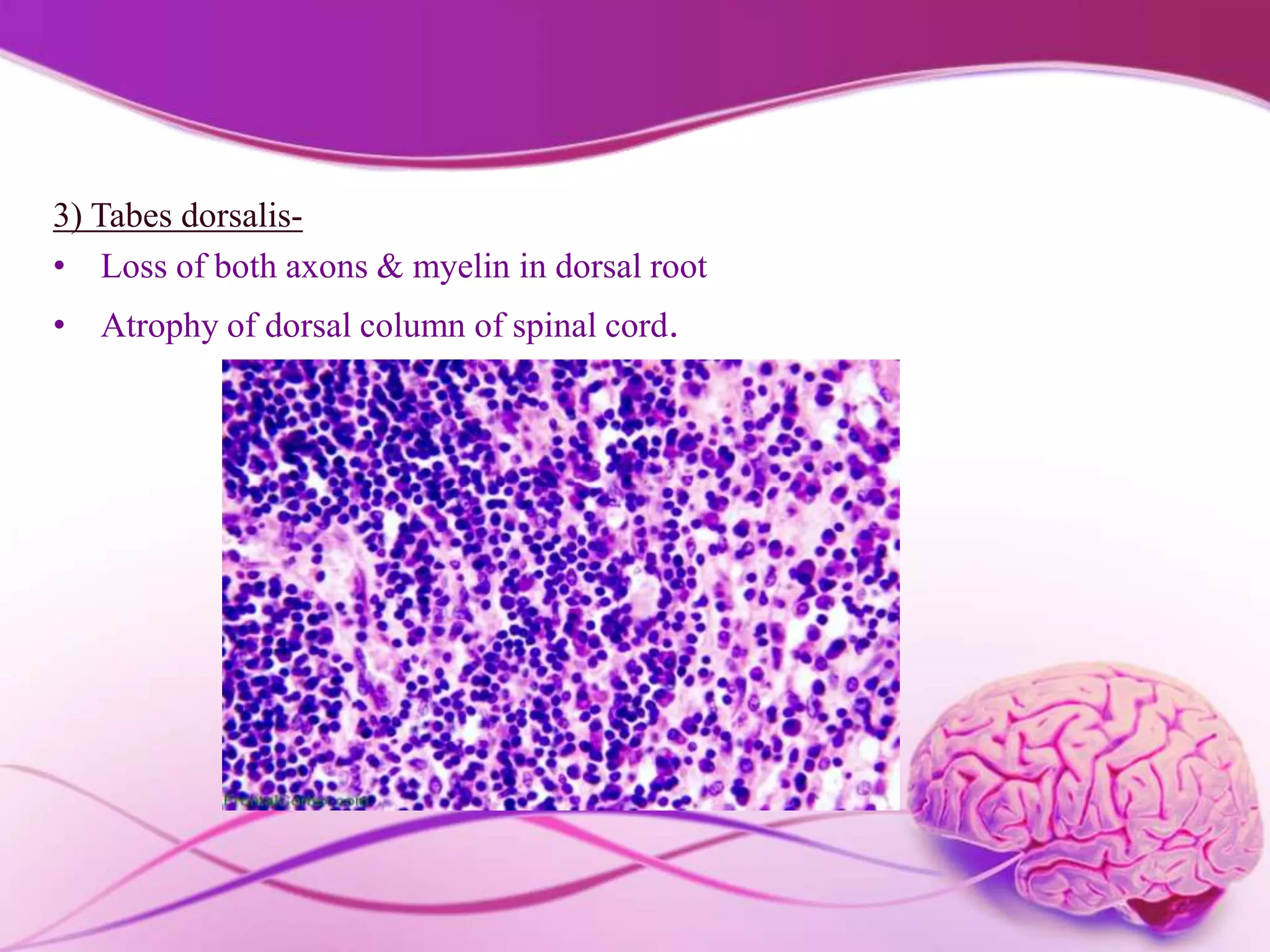 Pathology of cns | PPTX