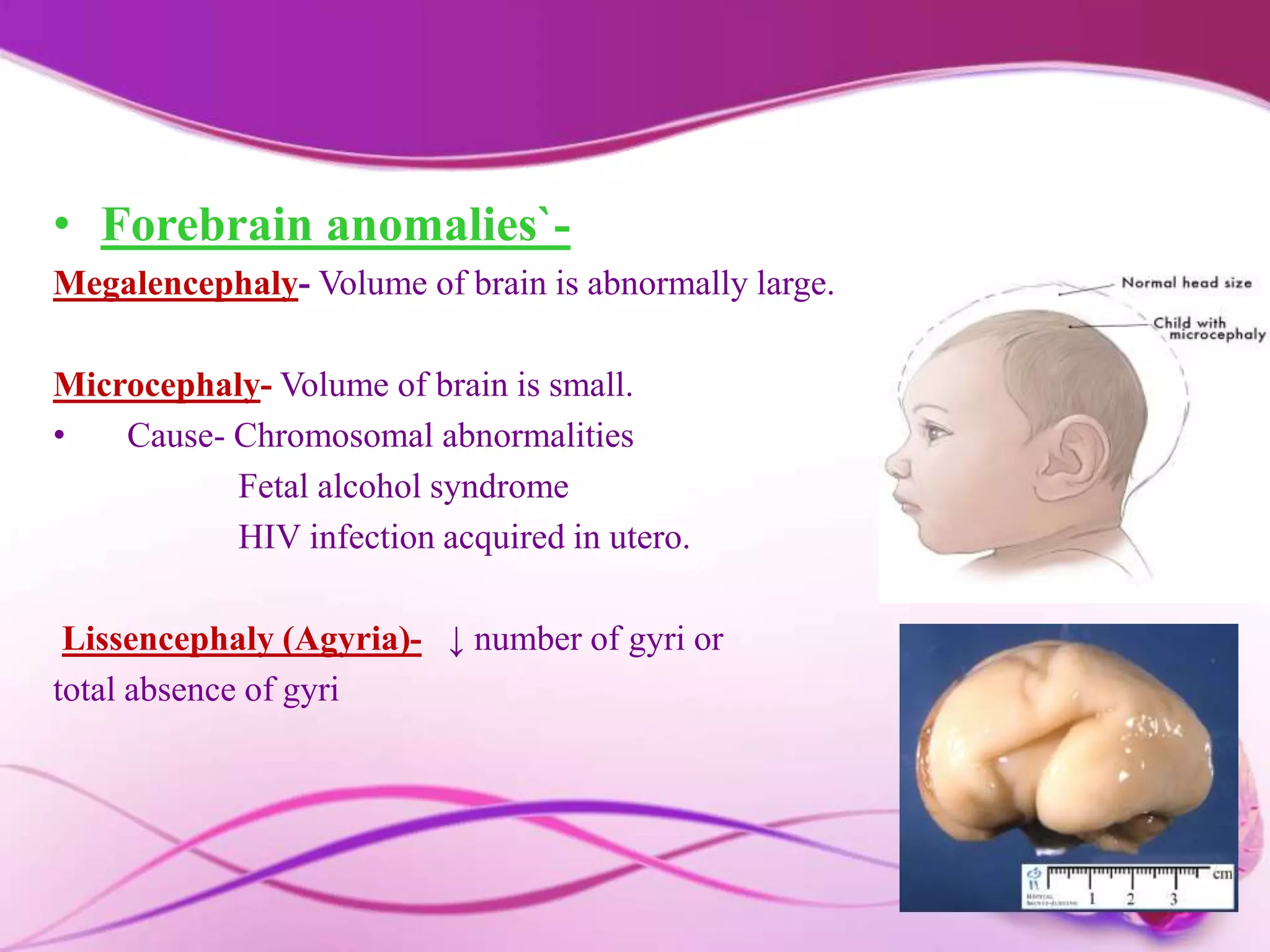 Pathology of cns | PPTX