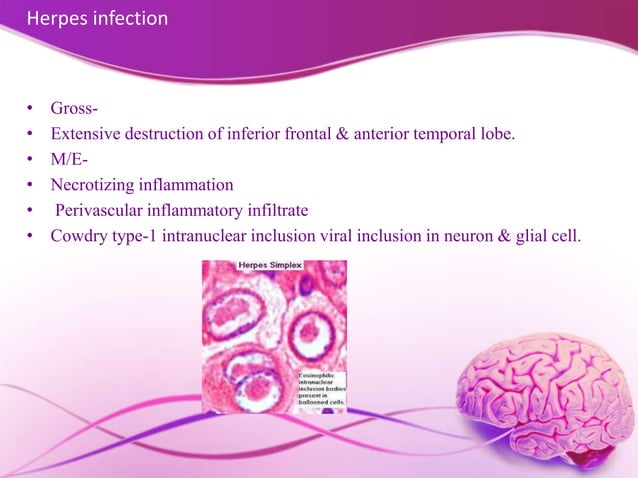 Pathology of cns | PPTX