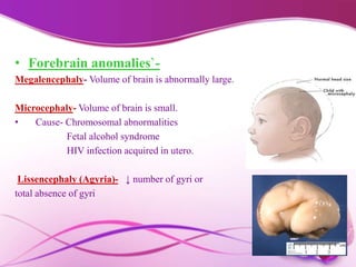 Pathology of cns | PPTX