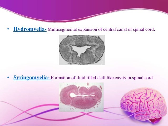 Pathology of cns