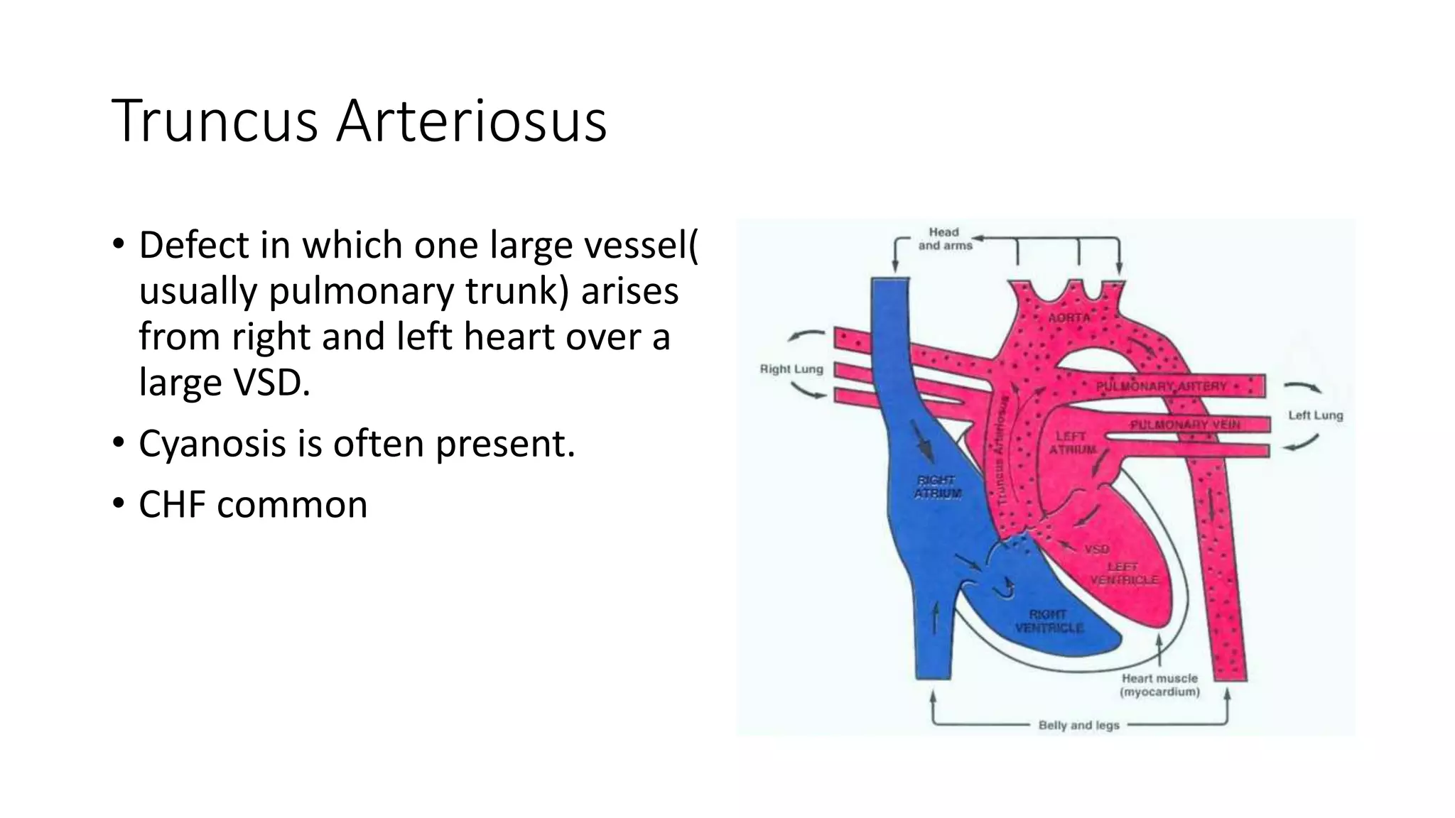 PATHOLOGY CONGENITAL HEART DISEASE IN CHILDREN | PPTX