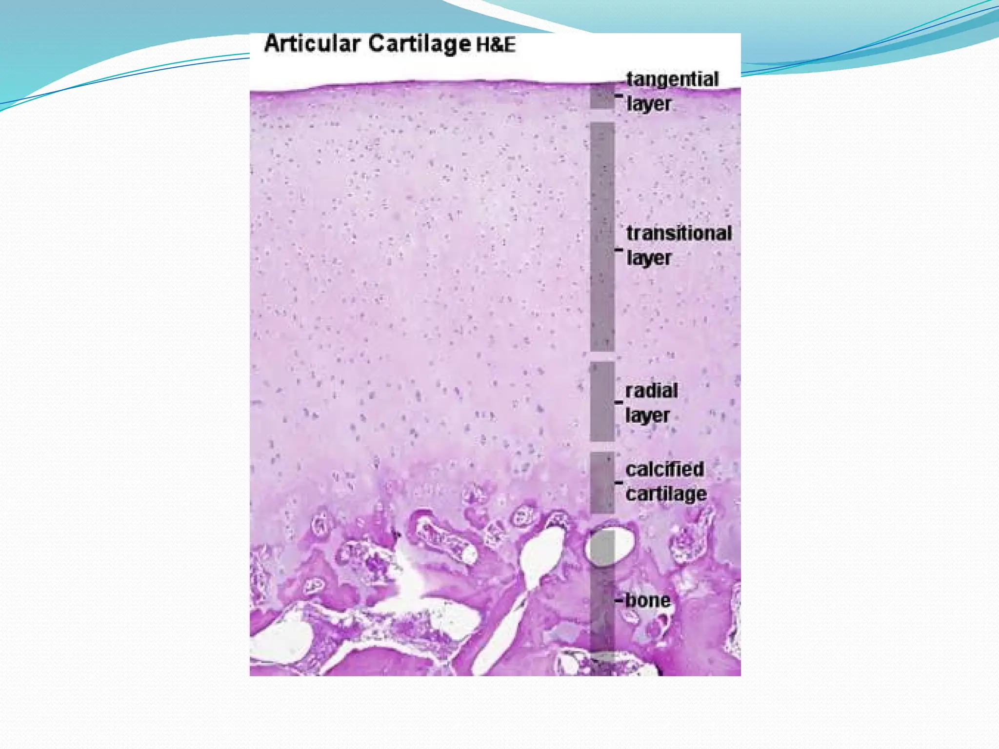 Pathology of degenerative arthritis ready - Copy.pptx