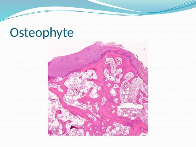 Pathology of degenerative arthritis ready - Copy.pptx