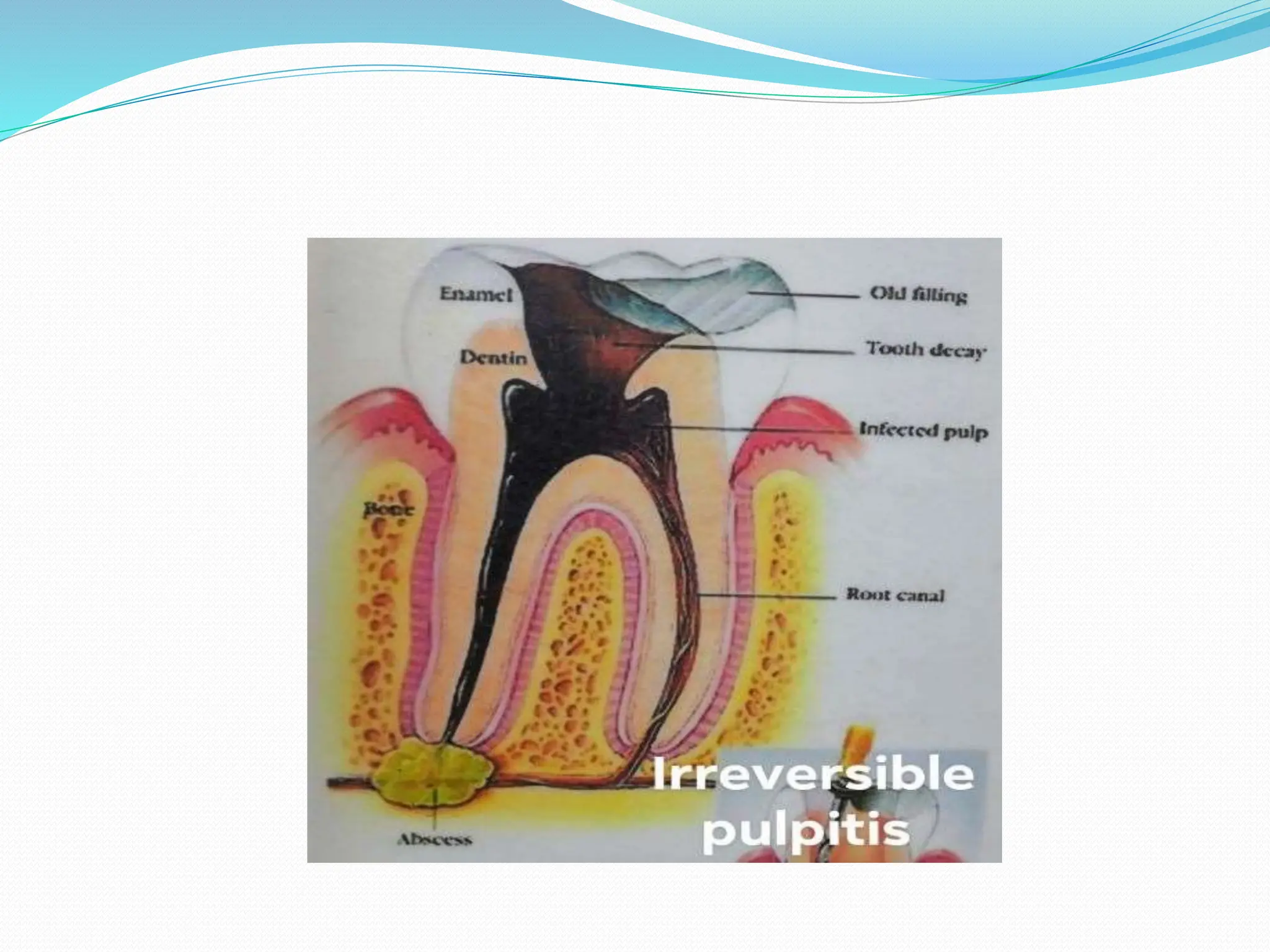 The Pathology of dental vital pulp.pptx