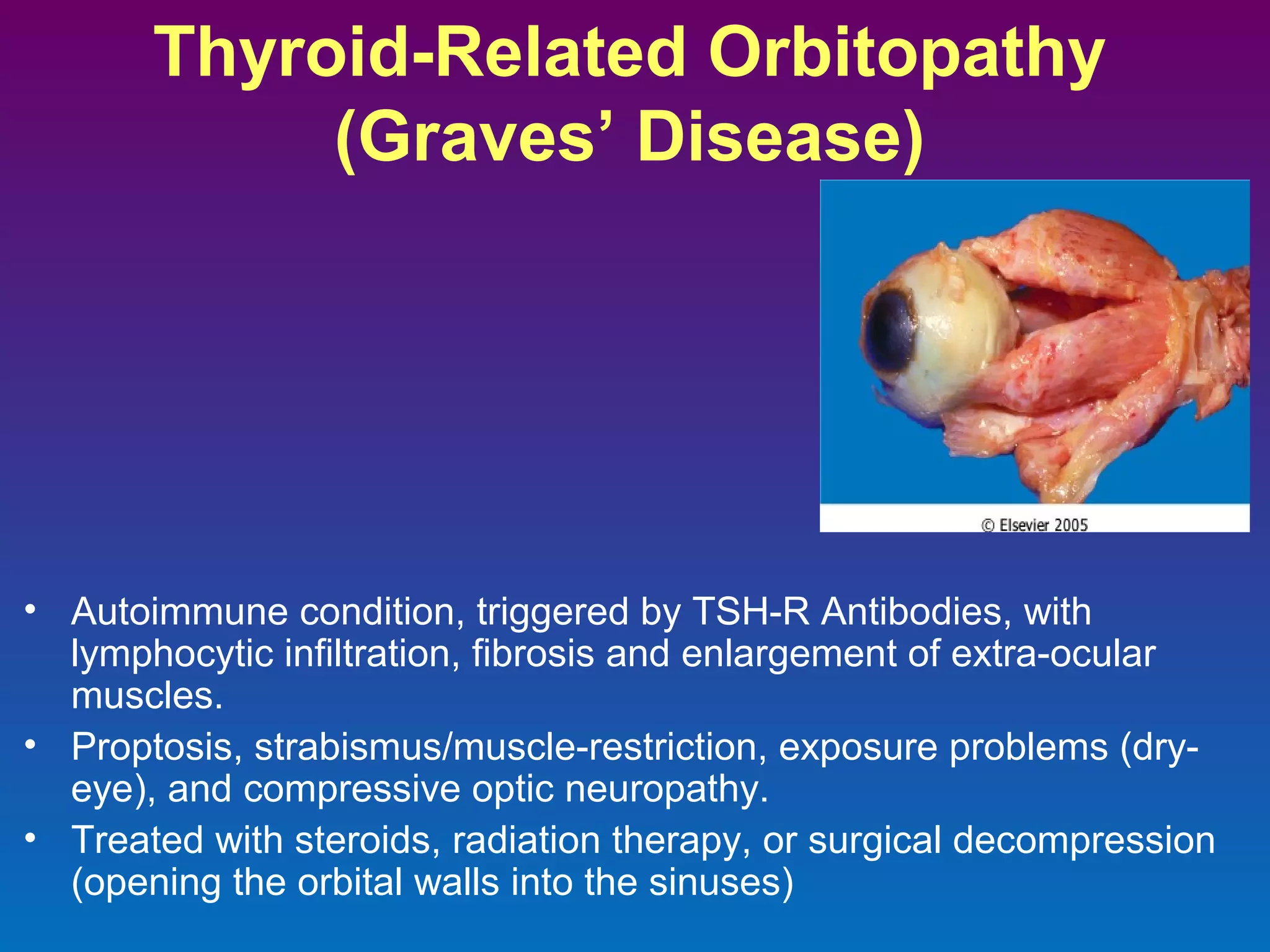 Pathology of eye i-2013-final | PPT
