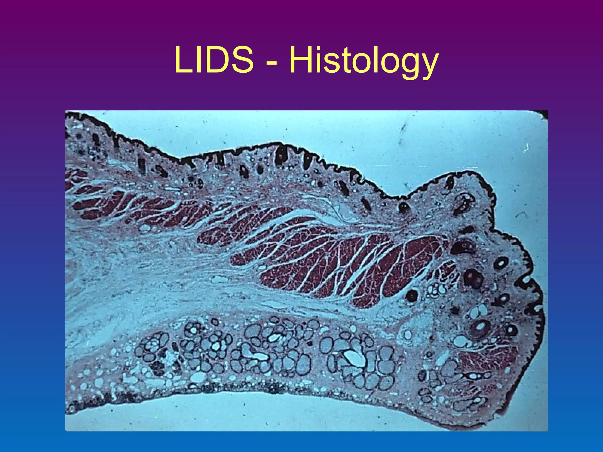 Pathology of eye i-2013-final | PPT