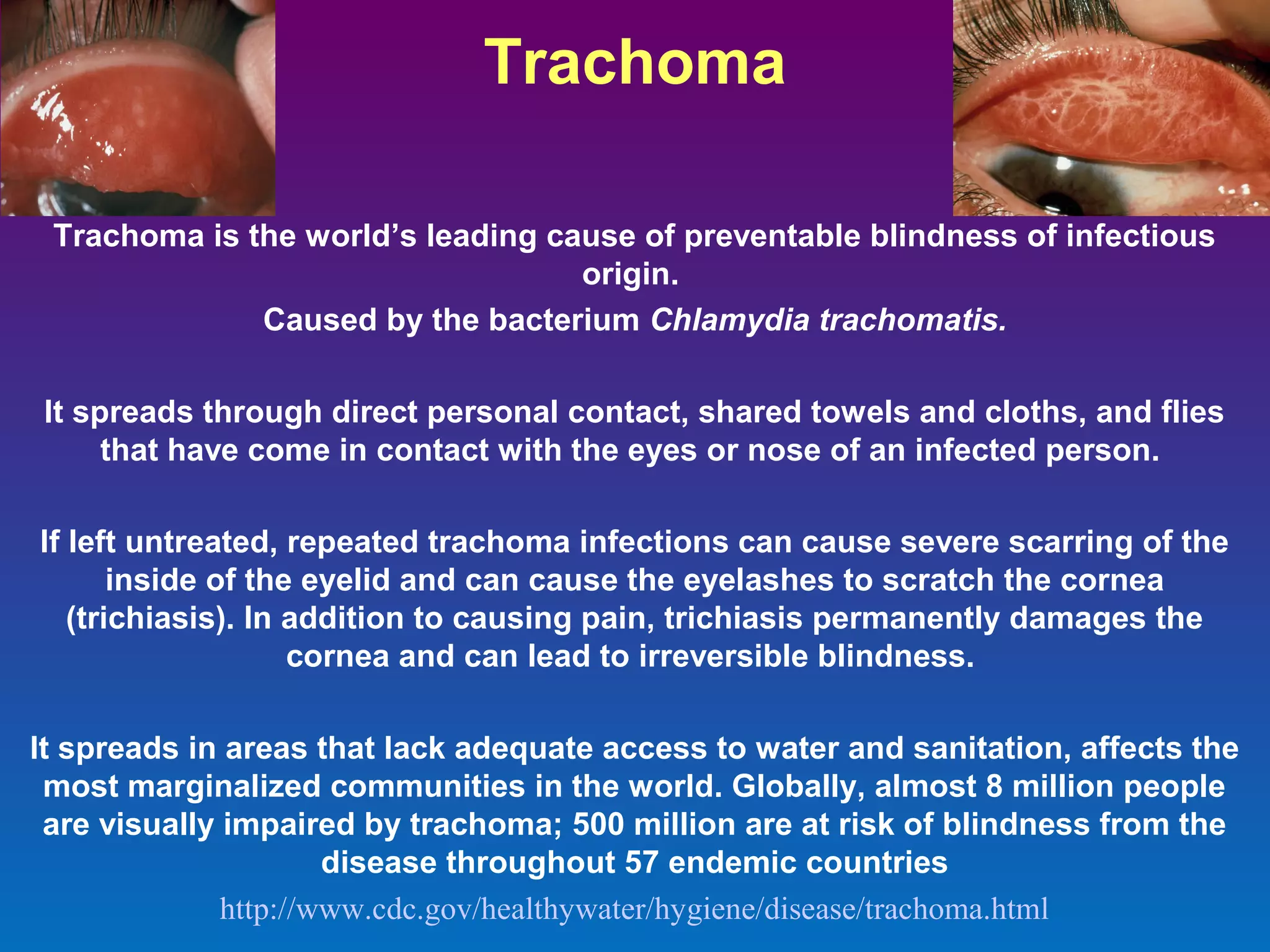 Pathology of eye i-2013-final | PPT