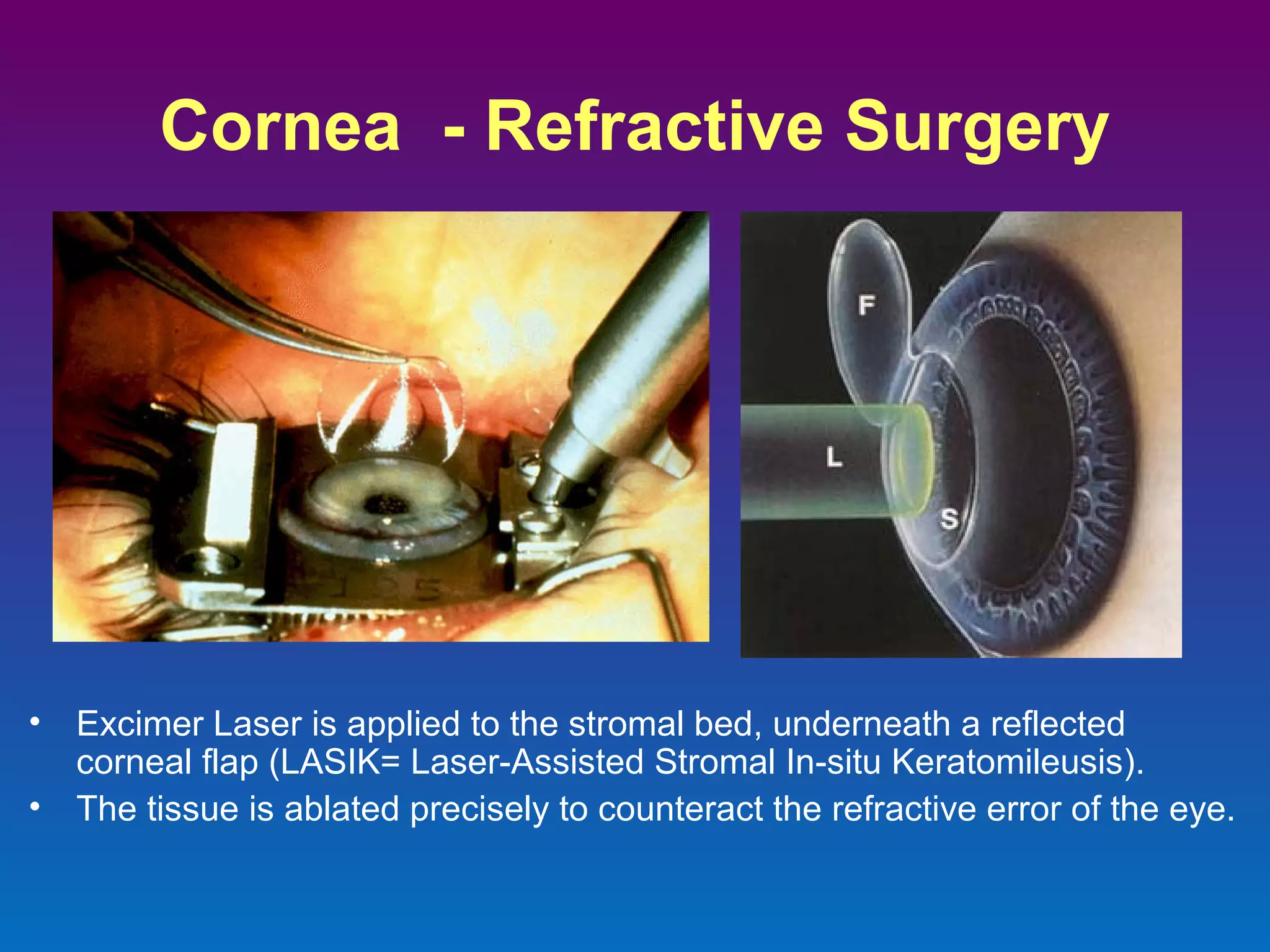 Pathology of eye i-2013-final | PPT