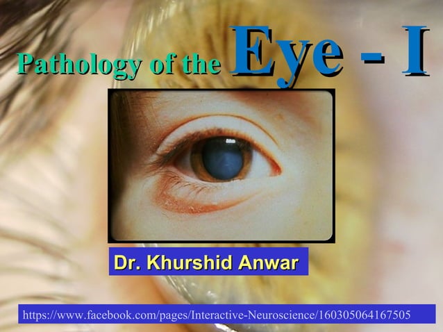 Pathology of eye i-2013-final | PPT | Eye and Vision Conditions ...