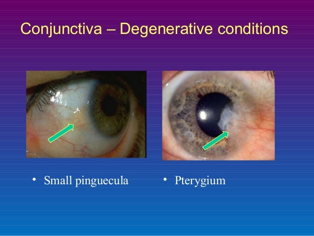 Pathology of eye i-2013-final
